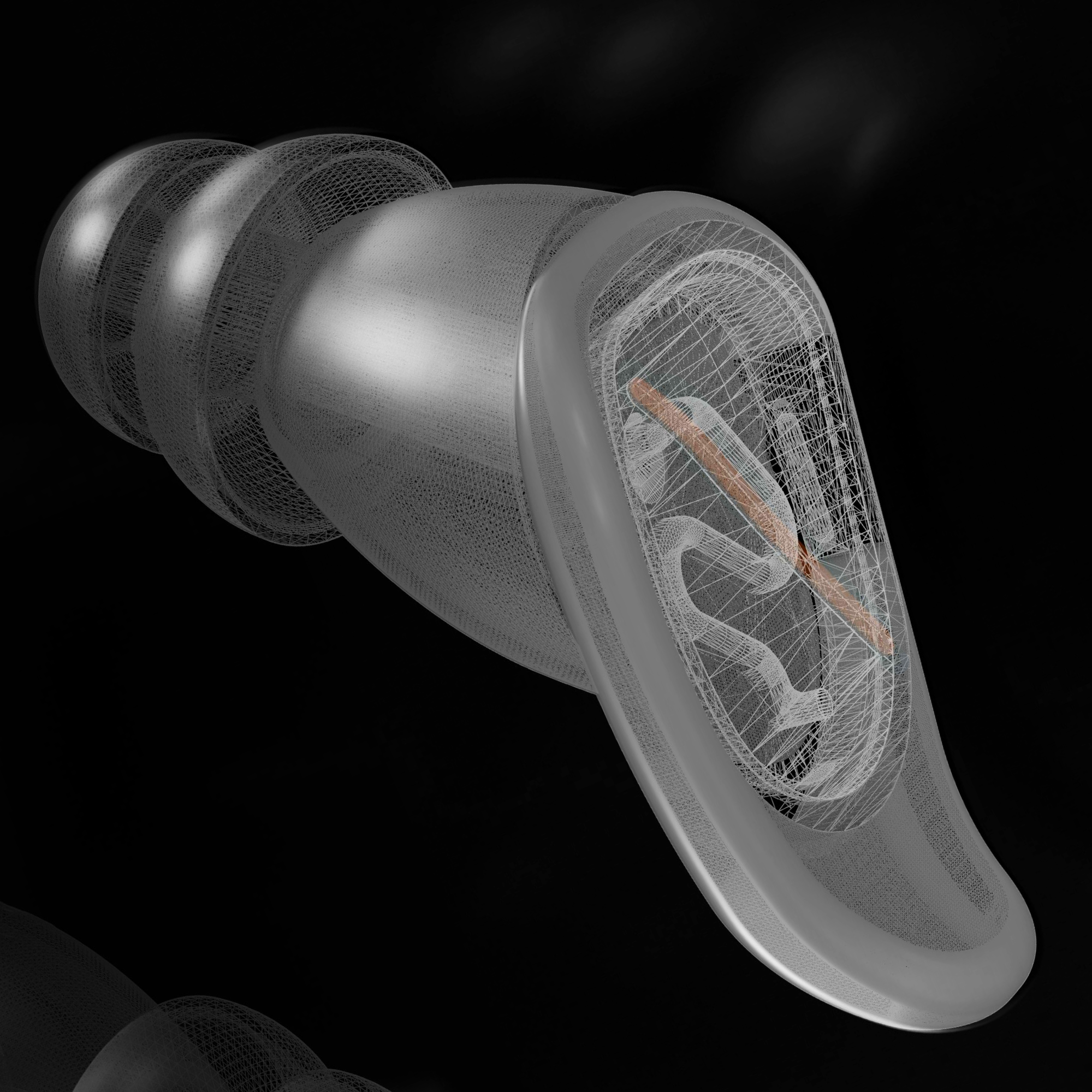 Hearing Damage is Permanent: Why EAROS is the Only Smart Choice for Co